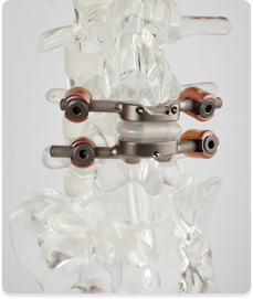 Das TOPS bei der Behandlung von spinaler Stenose | Damit Verbundener ...